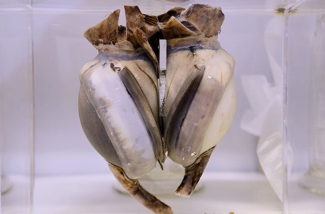 History of the artificial heart | Sanitas magazine