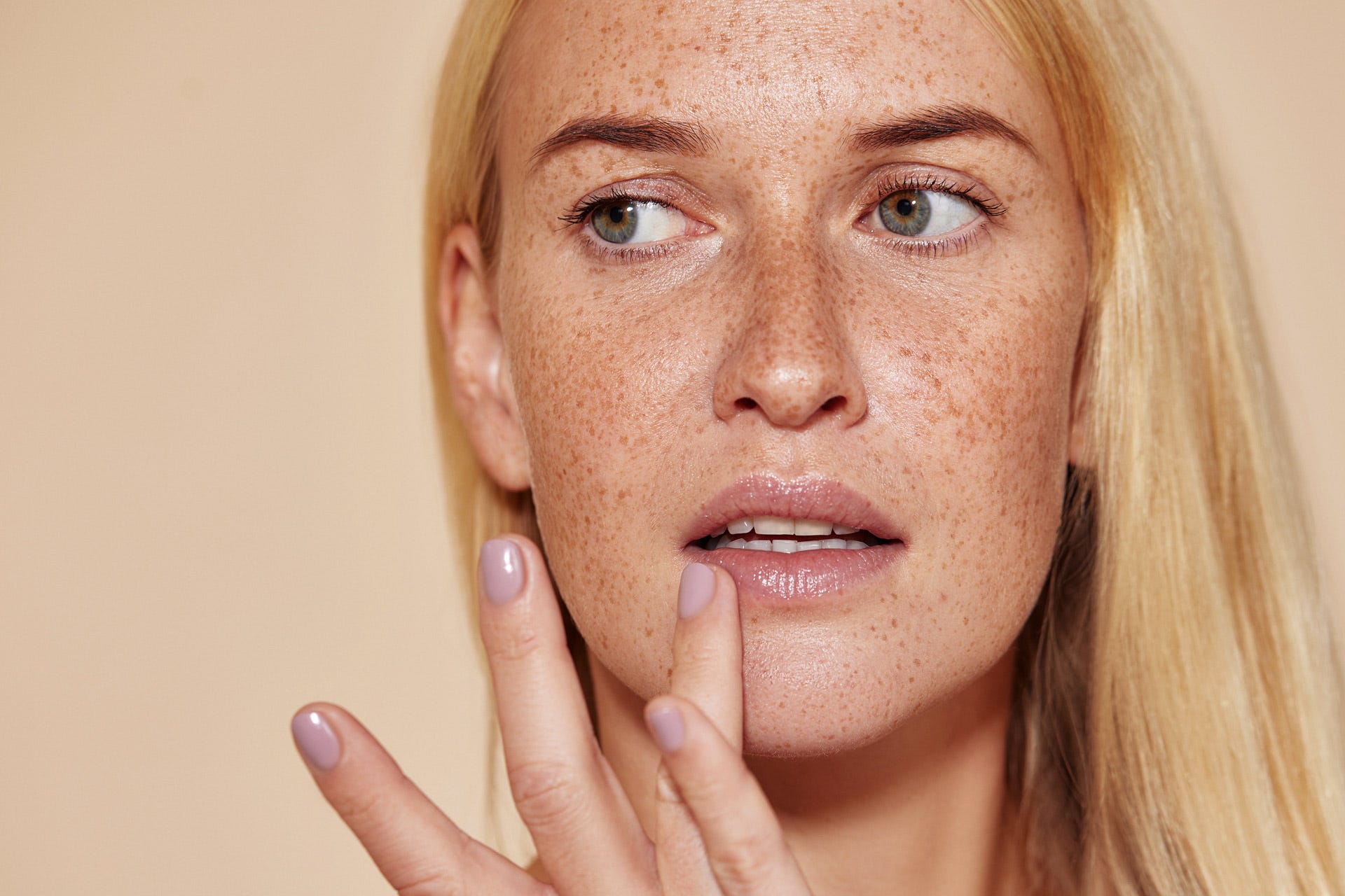 Herpes labiale (febbre delle labbra): cause, decorso, cura | Rivista ...